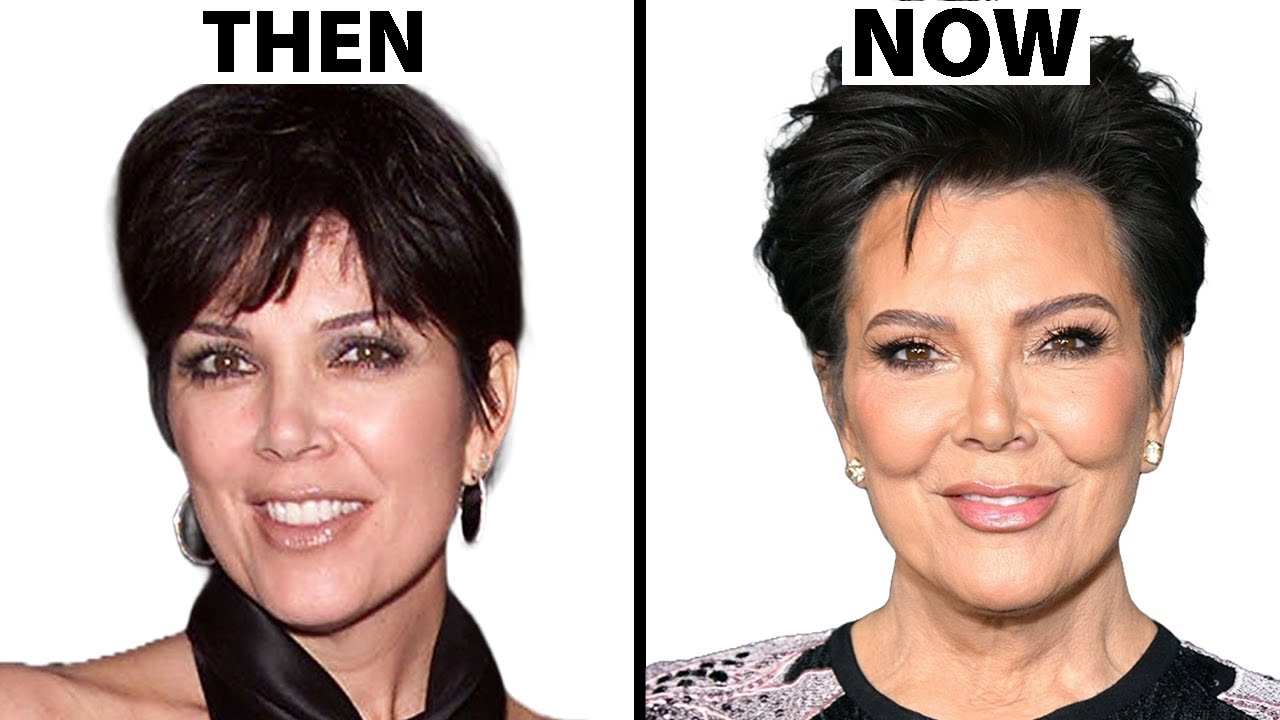 Kris Jenner’s Face Lift: What You Should Know – NewsHunts24 News